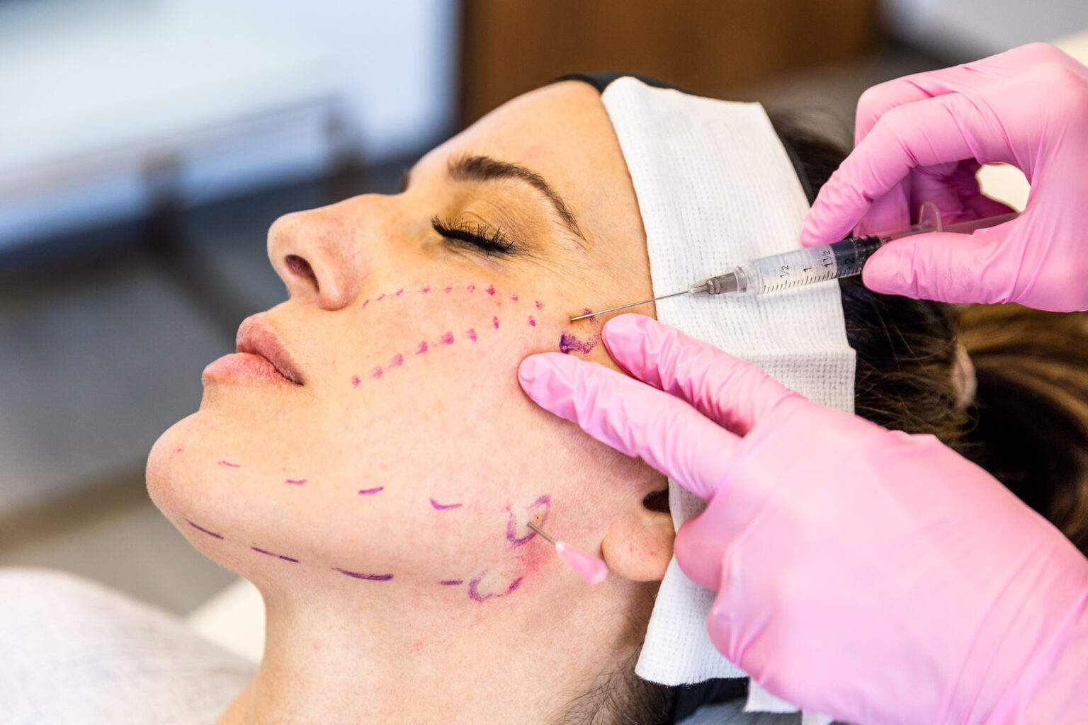 PDO Threads in Waxhaw | Dogwood Face & Body